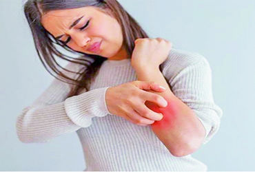 સ્કીન રોગ સાધ્ય આયુર્વેદ સાથે | Skin disease treatment with Ayurveda ...