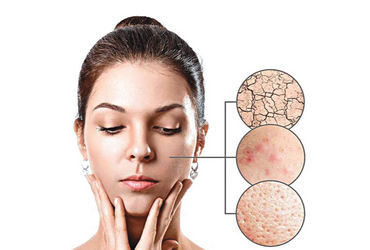 ટાઢમાં તતડતી ત્વચાની તકેદારીના સરળ ઉપાય | Simple Remedies for Dry Skin ...