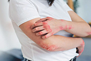 સ્કીન રોગ અને આયુર્વેદ . | Skin Diseases and Ayurveda - Gujarat Samachar